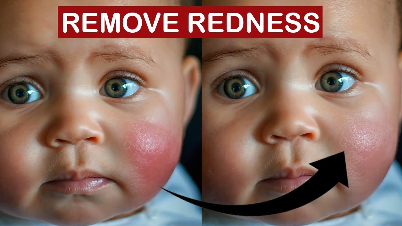 Remove Red Patches from Skin in Photoshop in 1 Minute - YouTube