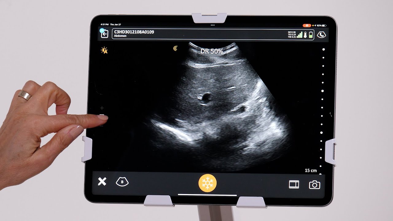 Adjusting Dynamic Range - YouTube