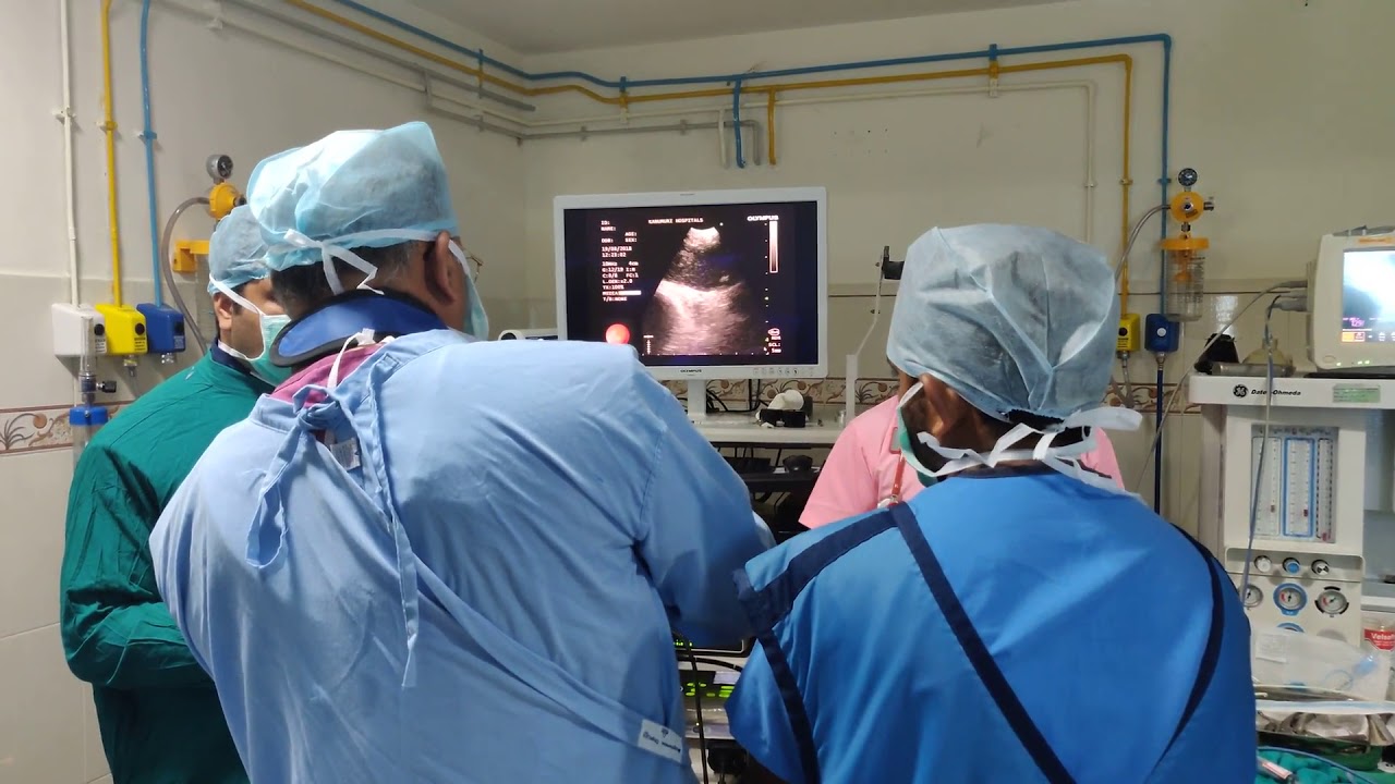 Thoracoscopy & EBUS - ENDOBRONCHIAL ULTRASOUND | Kanumuri Hospitals ...