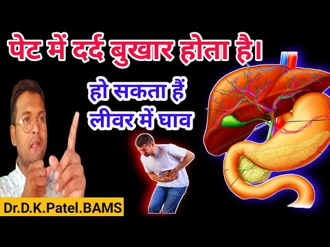 पेट में दर्द और बुखार होता है🤭लीवर में घाव हो सकता हैं 🤫Pet me dard kyu ...