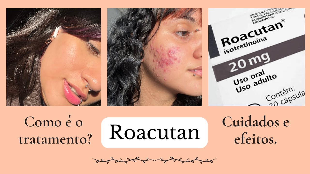 ROACUTAN | efeitos colaterais e skincare - YouTube