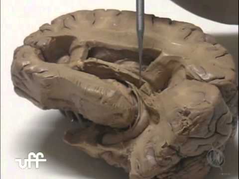 Neuroanatomia: morfologia ventricular 1