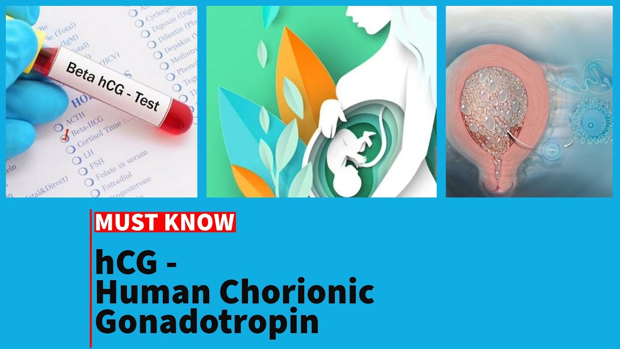 hCG | Human chorionic gonadotropin | beta-hcg | preganancy ...