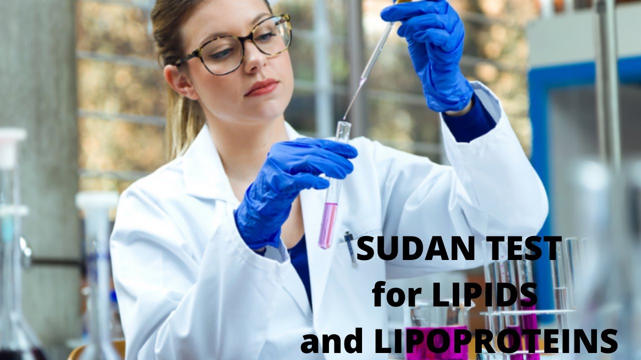 SUDAN test for Lipids and Lipoproteins - YouTube