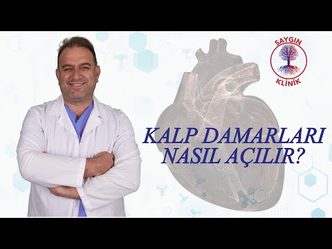 Tıkalı Kalp Damarları Nasıl Açılır?