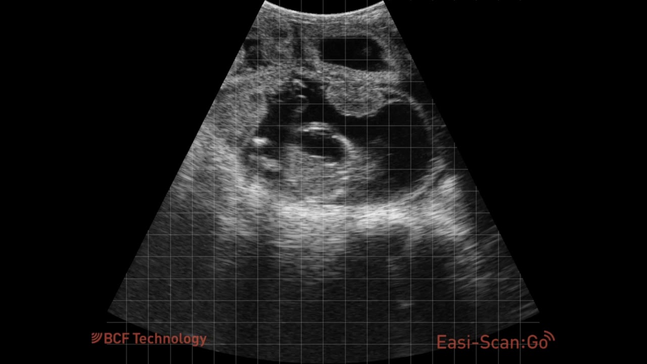 Bovine fetus 88 day calf - YouTube