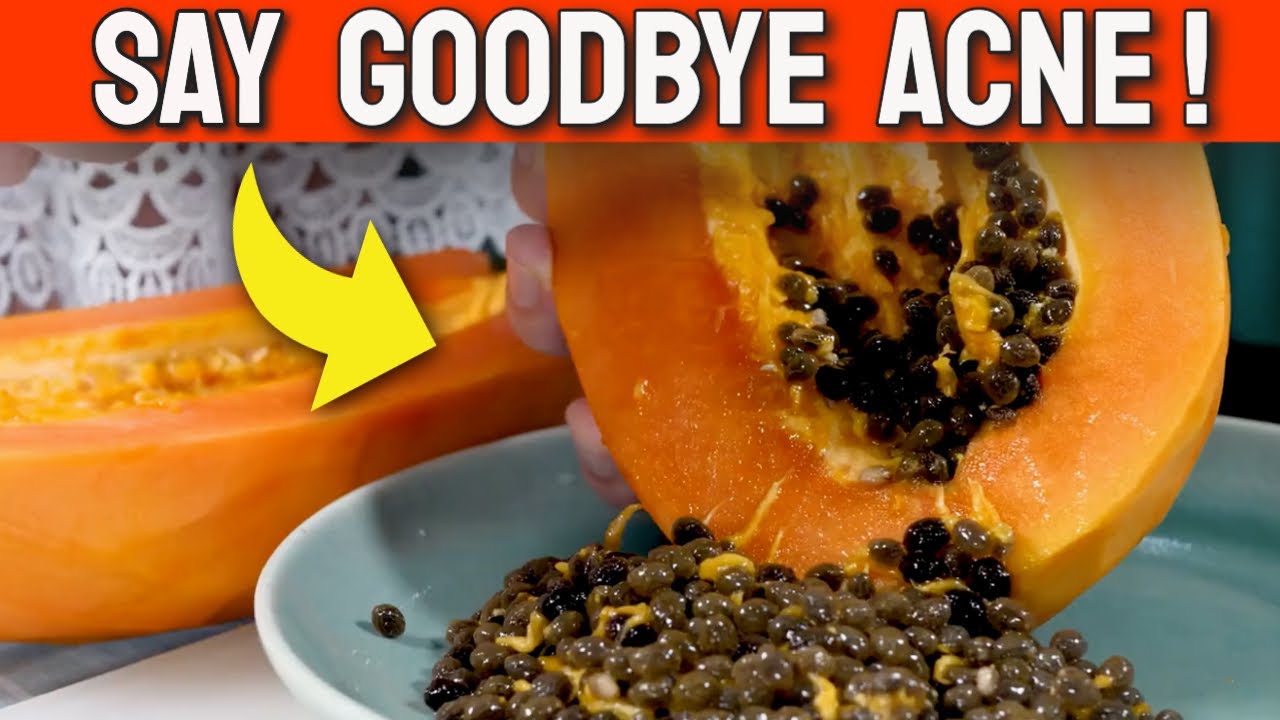 17 Anti Acne Foods You Must Eat To Get Rid Of Acne & Scars - YouTube