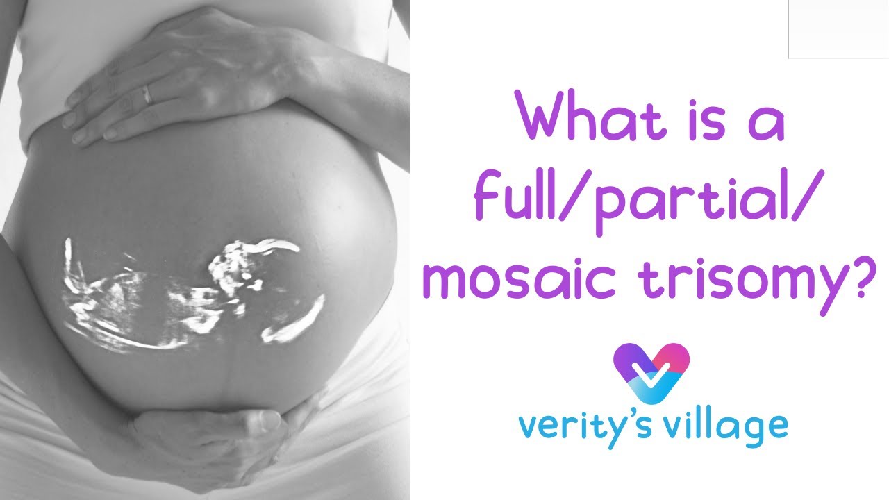 Full, Mosaic, & Partial Trisomy - YouTube