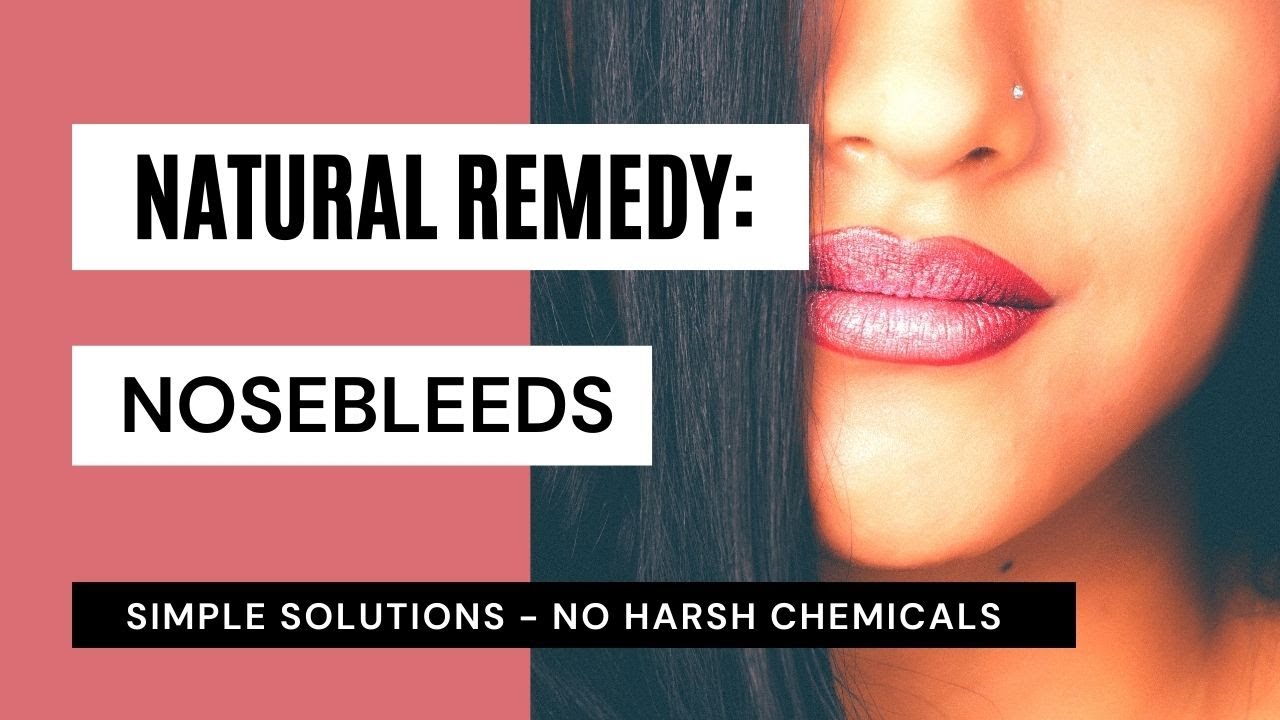 Natural Remedy: Nosebleeds - 3 Simple ways to stop a bloody nose - YouTube