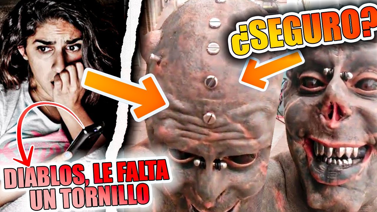 DIABLO PRADO se IMPLANTA una FILA DE TORNILLOS en la CABEZA y LE ENTRA ...