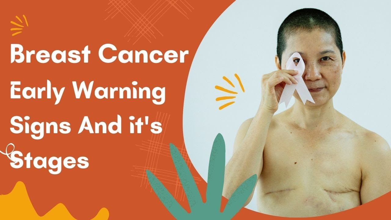 Early Signs of Breast Cancer: Know the Warning Signs and Stages! - YouTube