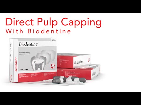 Biodentine Direct Pulp Cap - YouTube