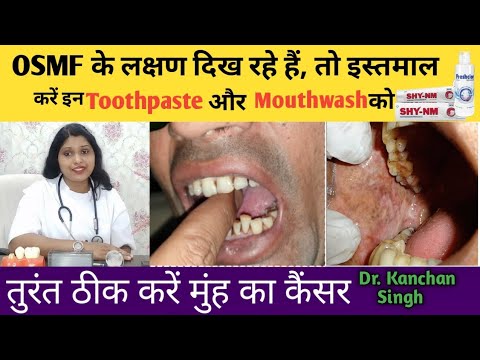 osmf toothpaste and mouthwash /osmf में इस्तमाल होने वाले टुथपेस्ट/Dr ...