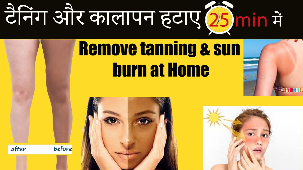 how to remove tan / tanning at home | home remedy | natural remedy ...