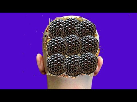 Extreme ASMR Maggot Removal | Unbelievable Scalp Extraction Sounds ...