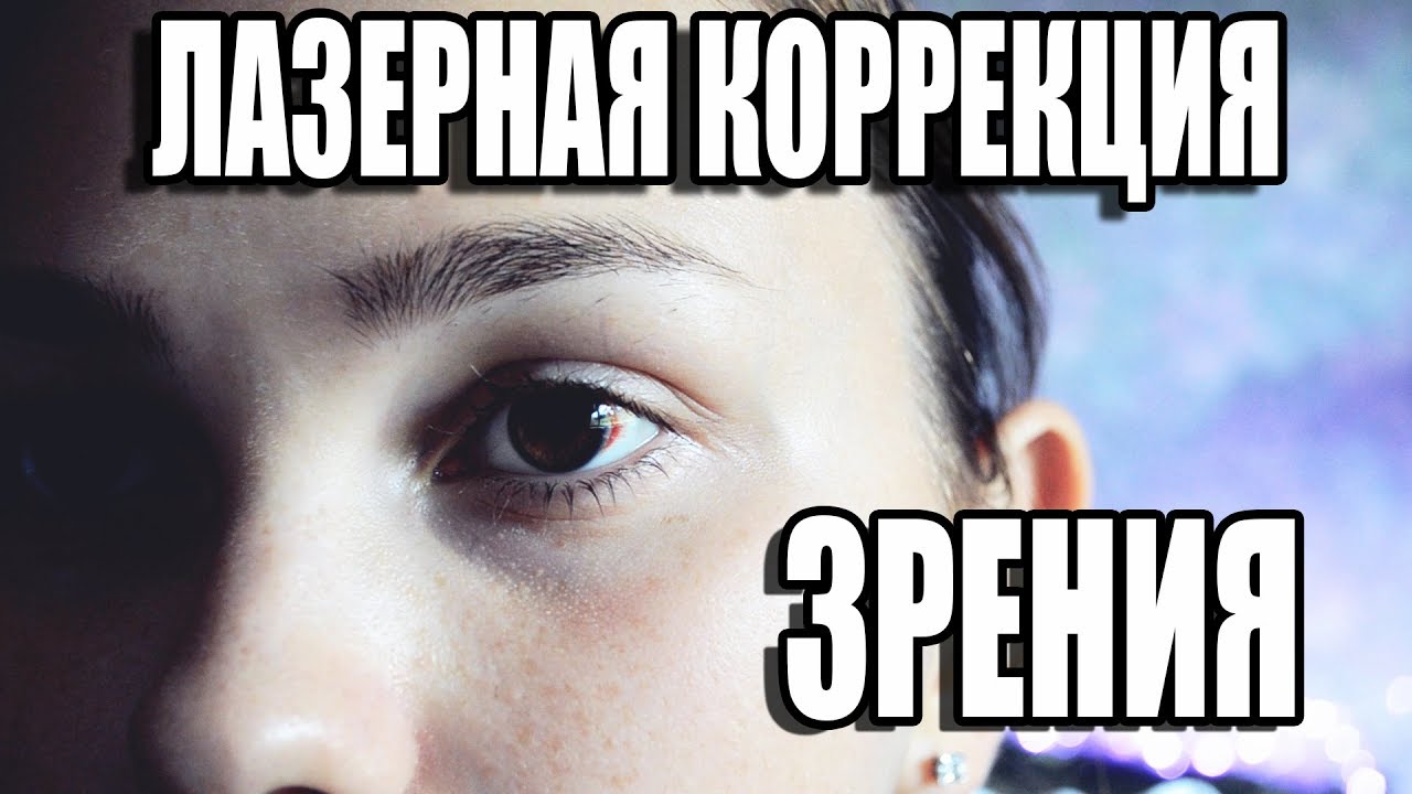 ЛАЗЕРНАЯ КОРРЕКЦИЯ ЗРЕНИЯ | МОЯ ОПЕРАЦИЯ | MARIA VIOLET - YouTube