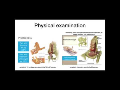 Clinical diagnosis +Ddx of Acute Appendicitis (Schwartz,11e Vs UpToDate ...