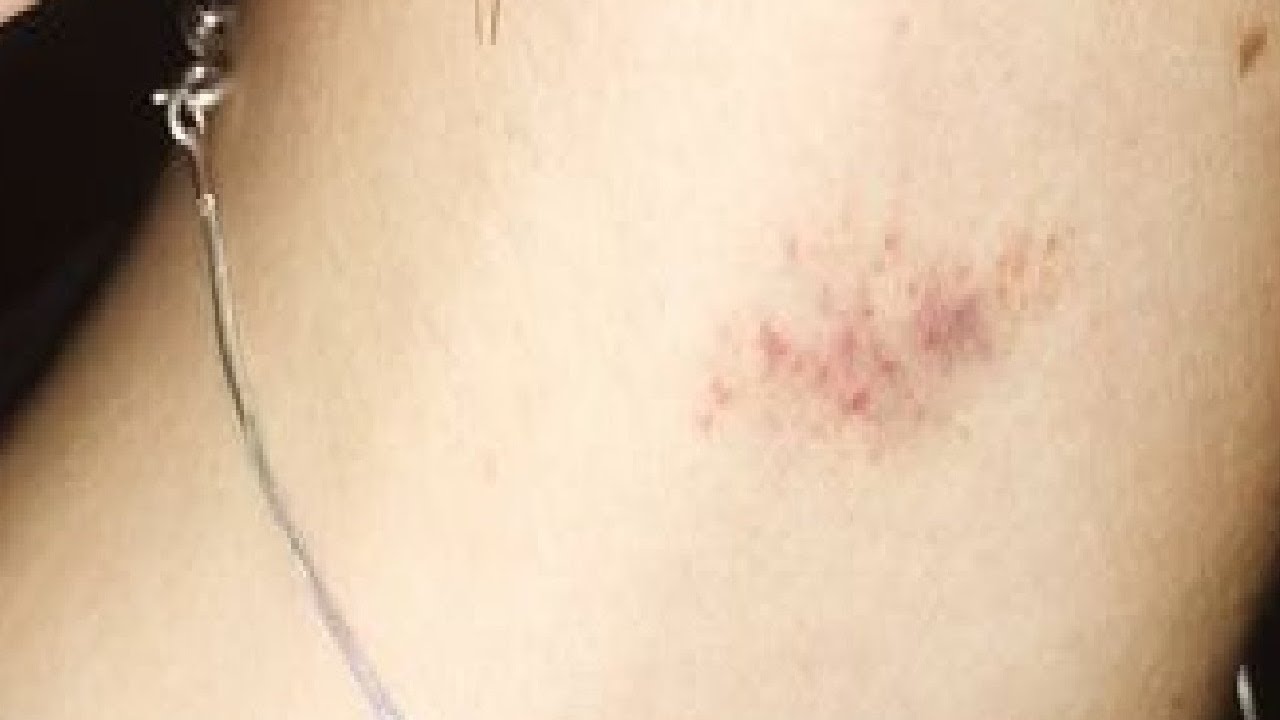 how to give a hickey with your hand fast - YouTube