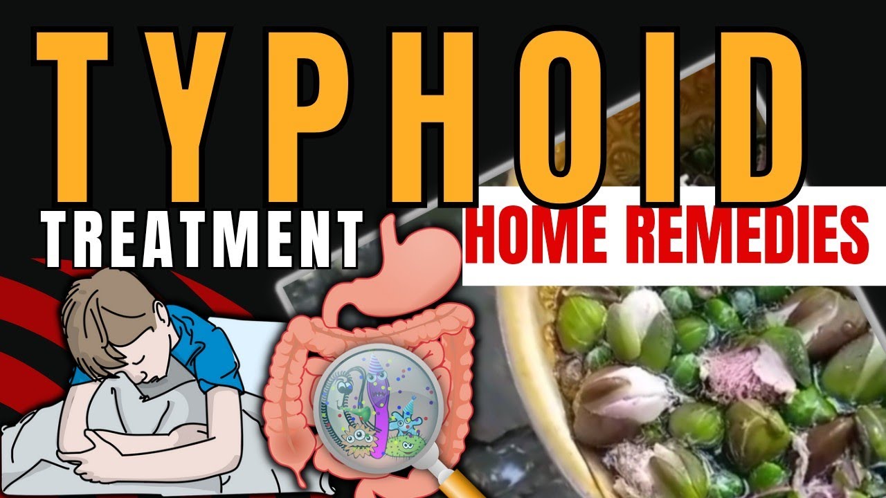 Easy Homemade recipe for treatment of Typhoid fever | Typhoid treatment ...