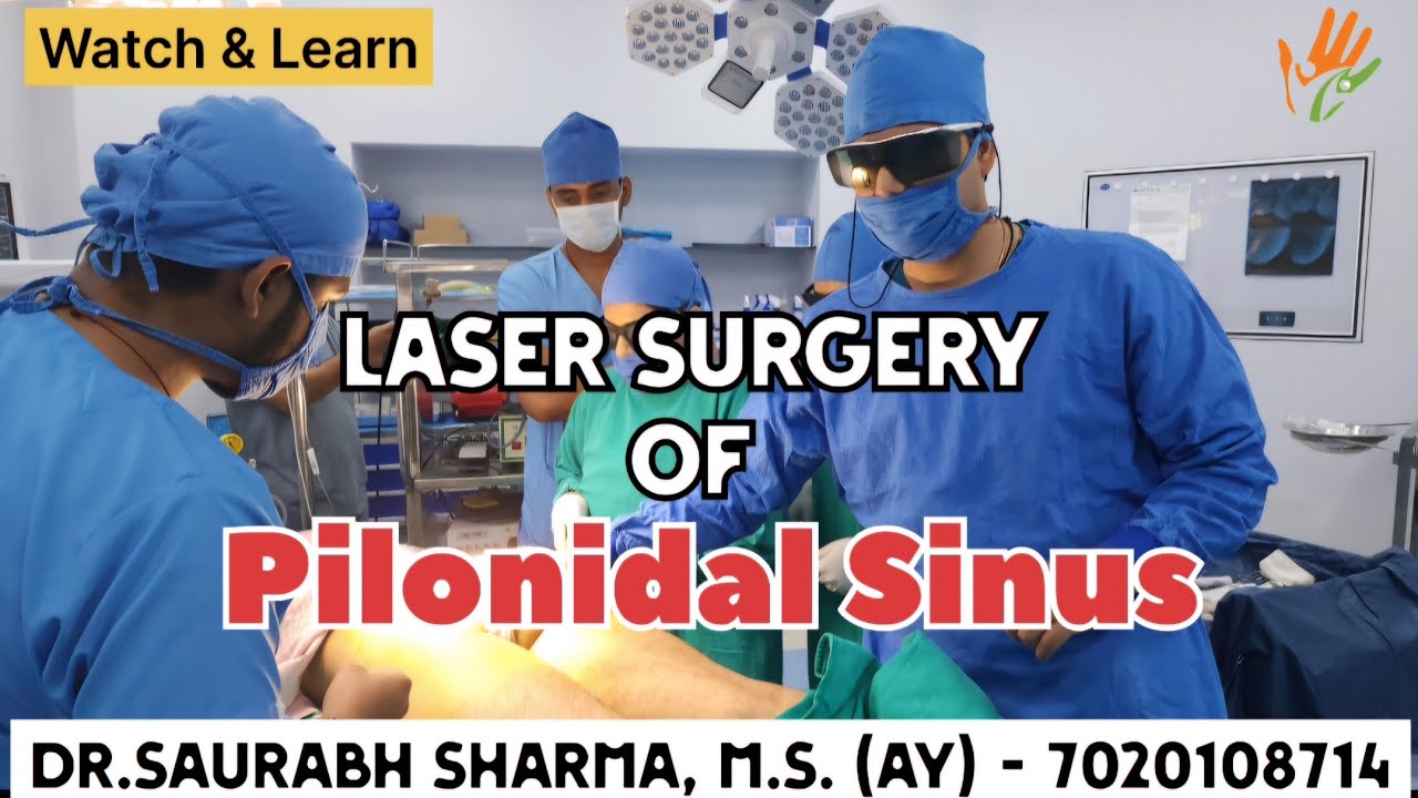 LASER Surgery of Pilonidal Sinus Explained👌पाइलोनिडल साइनस की लेज़र ...