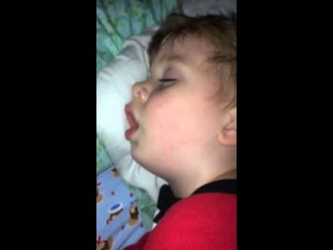 Pediatric snoring. Enlarged tonsils & adnoids. Tonsillectomy - YouTube