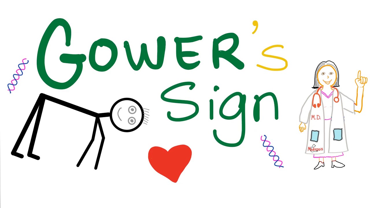 Gower Sign - Duchenne Muscular Dystrophy (DMD) - Signs in Medicine ...