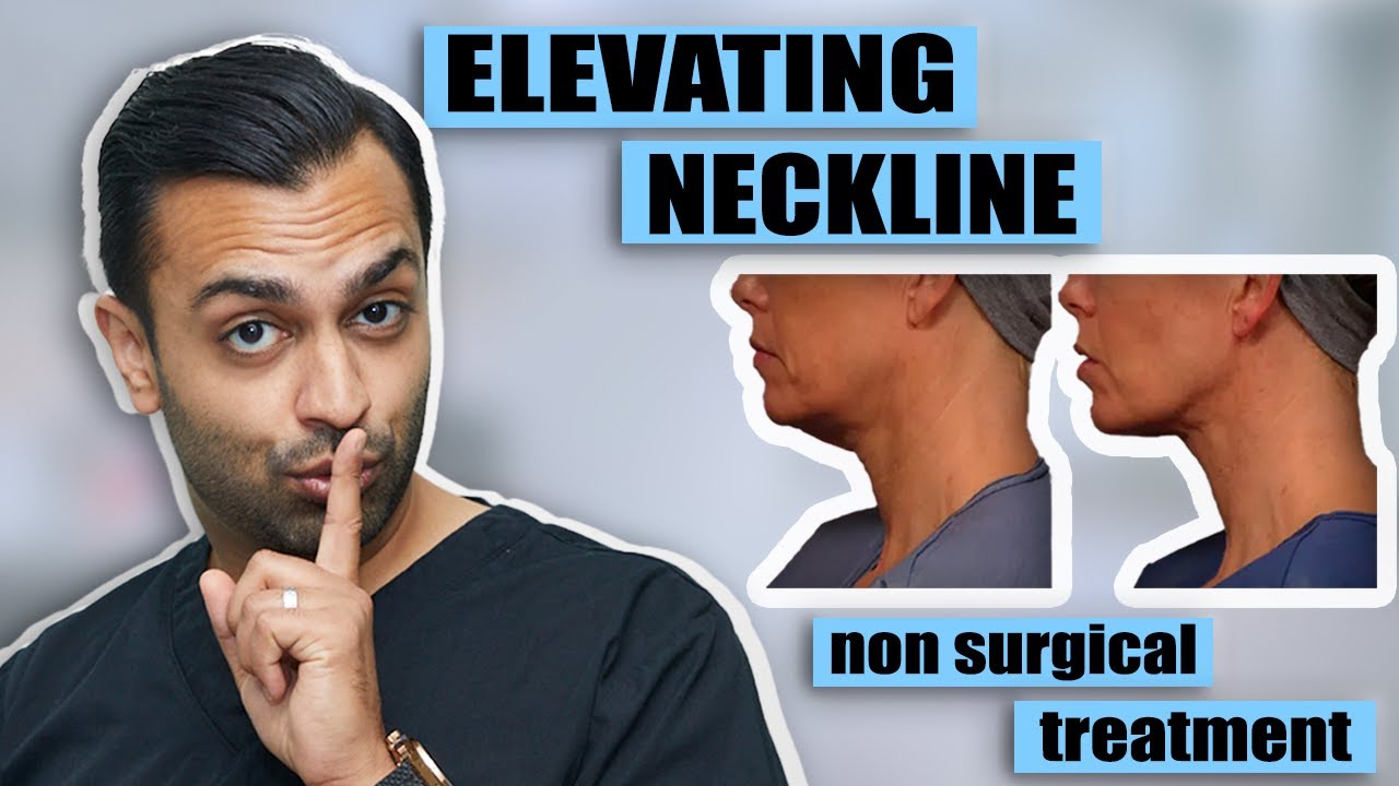 How to Elevate Your Neckline Non-surgical | Dr. Somji Explains ...