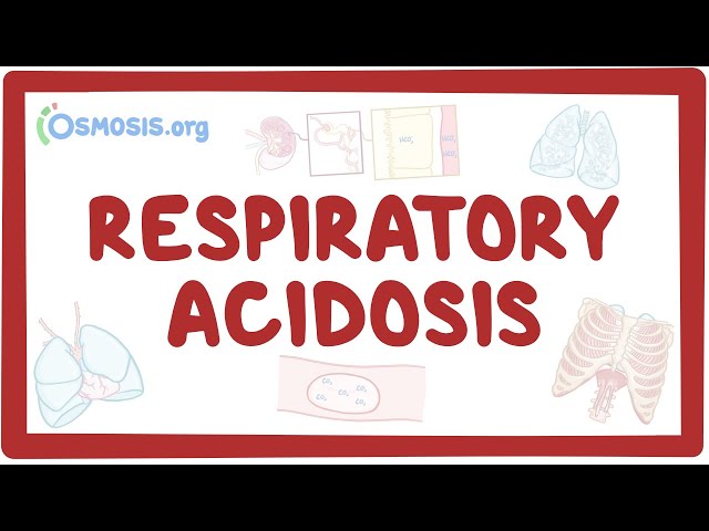 Respiratory Acidosis Pathophysiology And Management Of Respiratory And