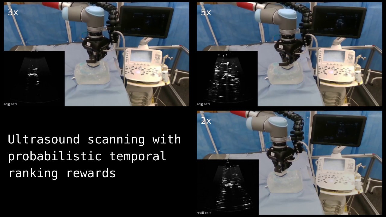 Learning robotic ultrasound scanning using probabilistic temporal ...