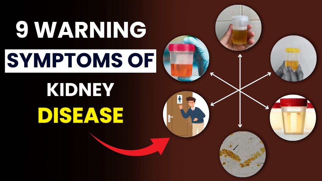 9 Kidney Warning Signs in Your Urine You Should NEVER Ignore | Symptoms ...