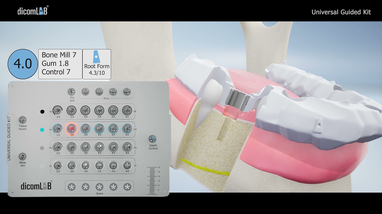 dicomLAB Universal Guided Kit - COMING SOON - YouTube