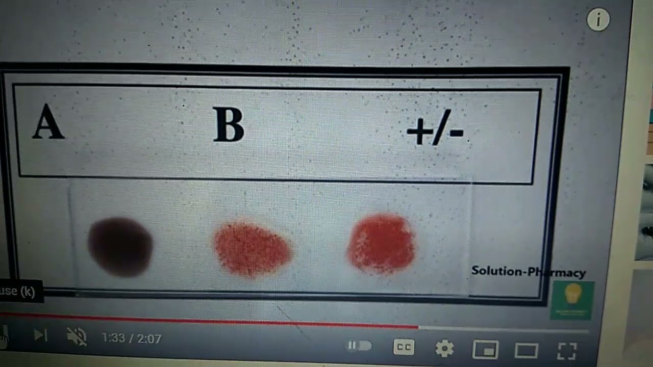 How to check blood type - YouTube