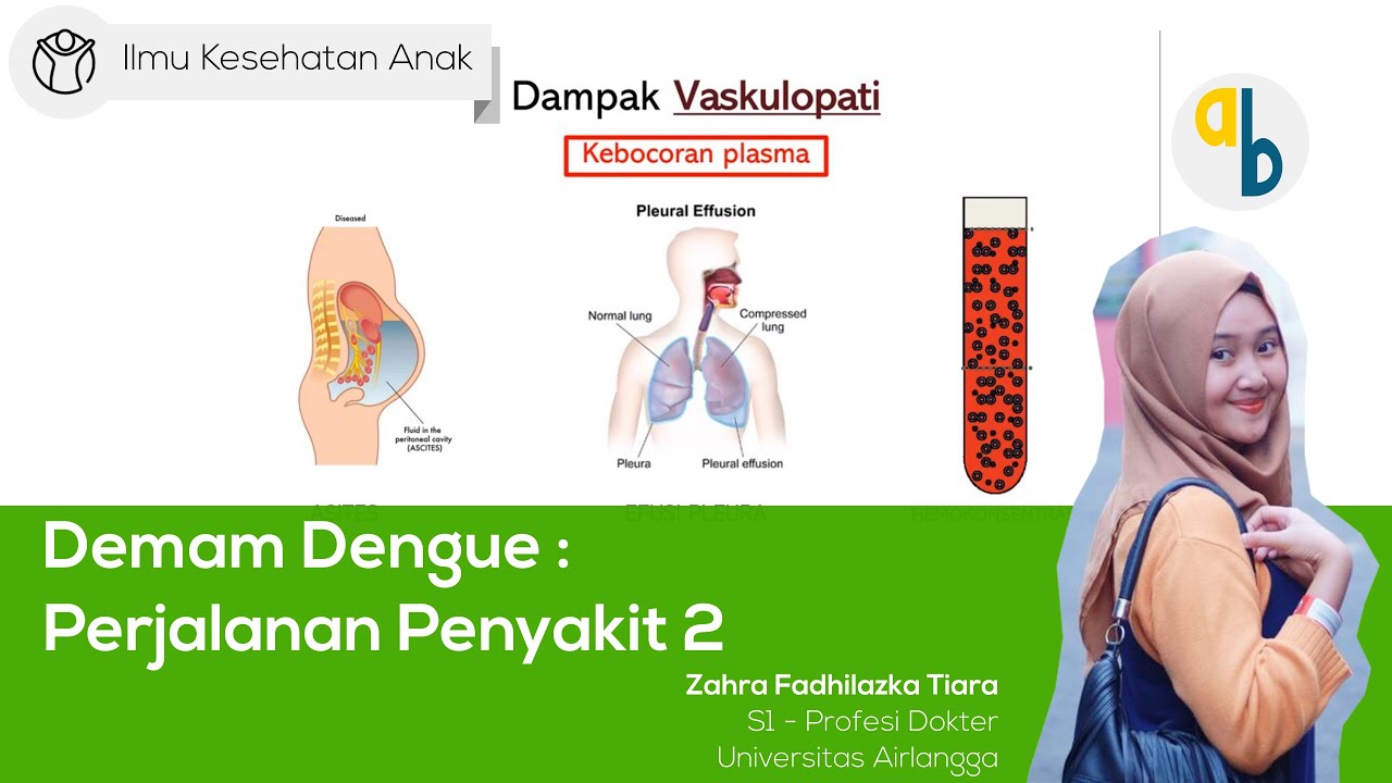 Perjalanan Demam Dengue Part II - YouTube