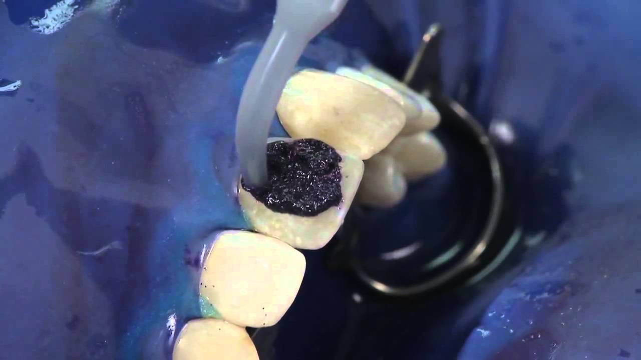 Opalustre Step by Step - YouTube