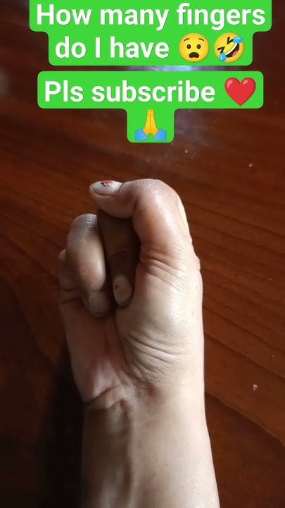 how many fingers do I have 😧🤣 short #youtubeshorts #trending #viralvideos #hand trick - YouTube