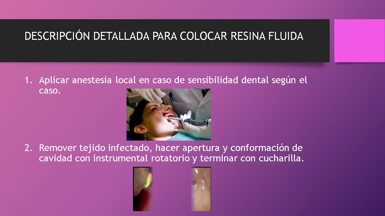 RESINAS FLUIDAS - YouTube