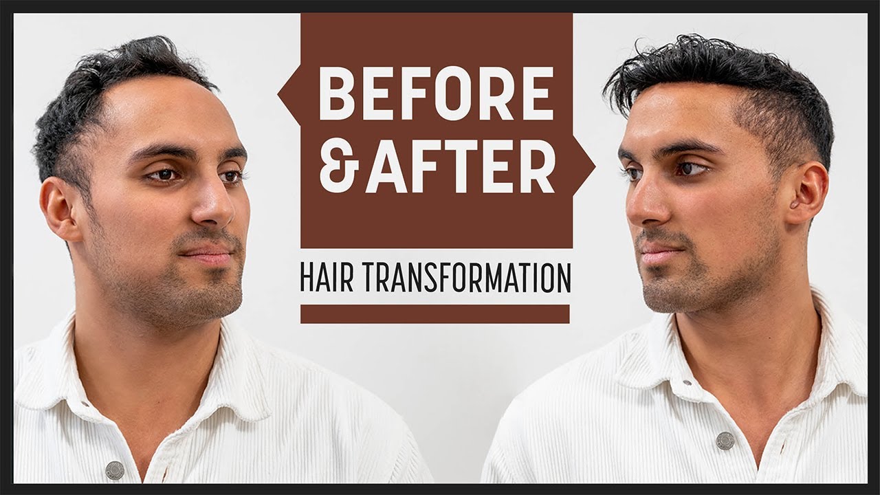 Receding hairline covered up with front hair system (+ extra advice for ...