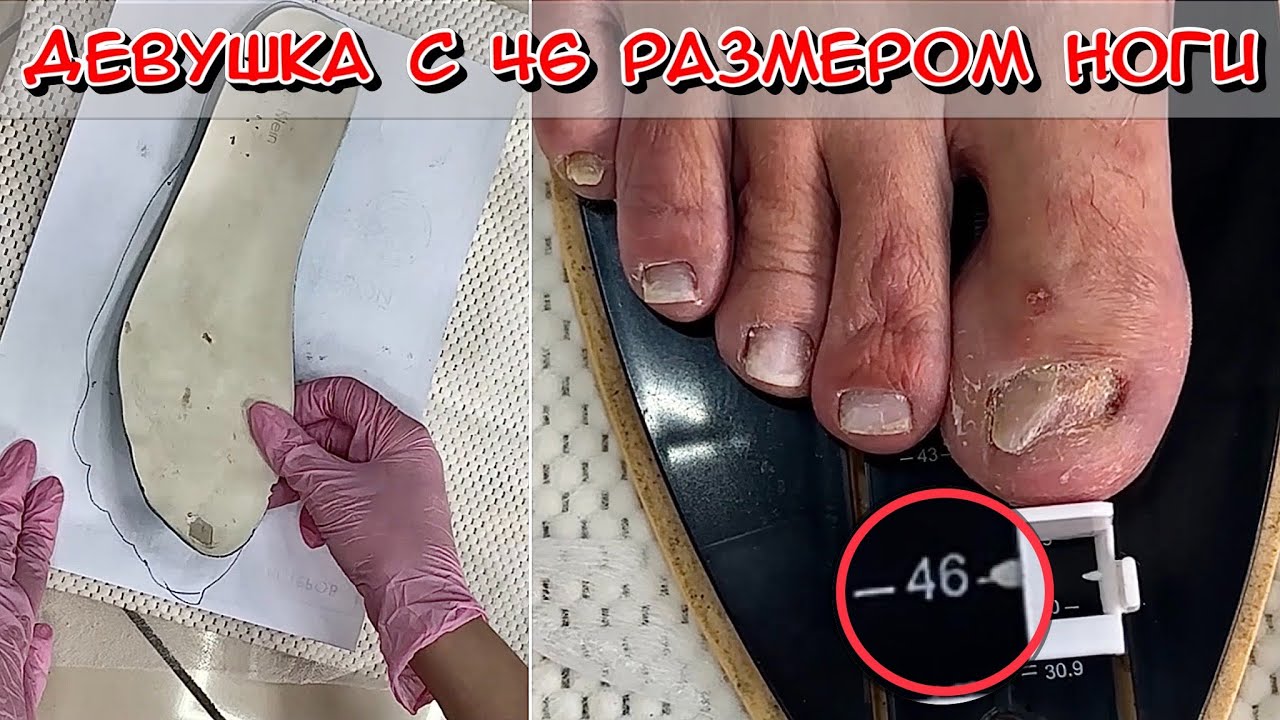 У девушки 46 размер ноги / Покажи это своим клиентам / Обувь по размеру ...