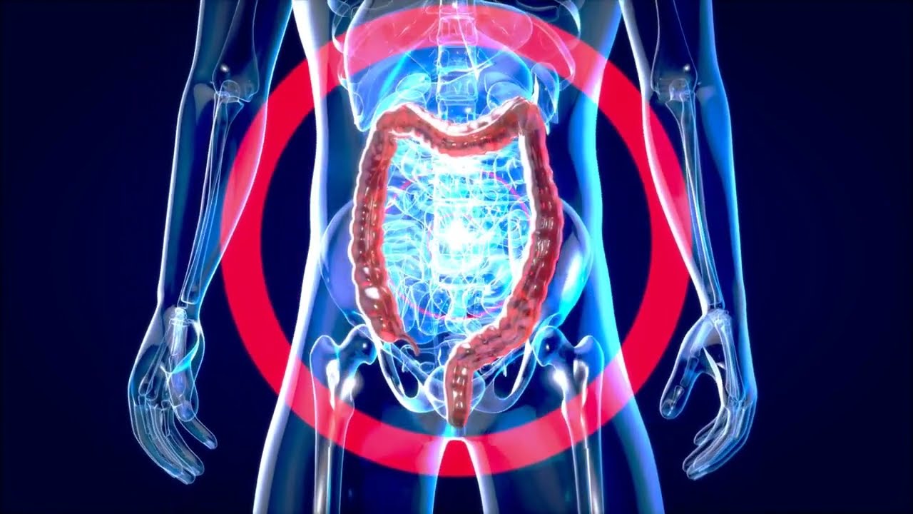 No copyright Stomach pain animated video - YouTube