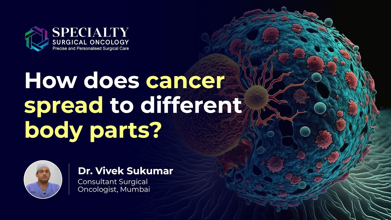 How do other organs become infected with cancer? | Dr. Vivek Sukumar ...
