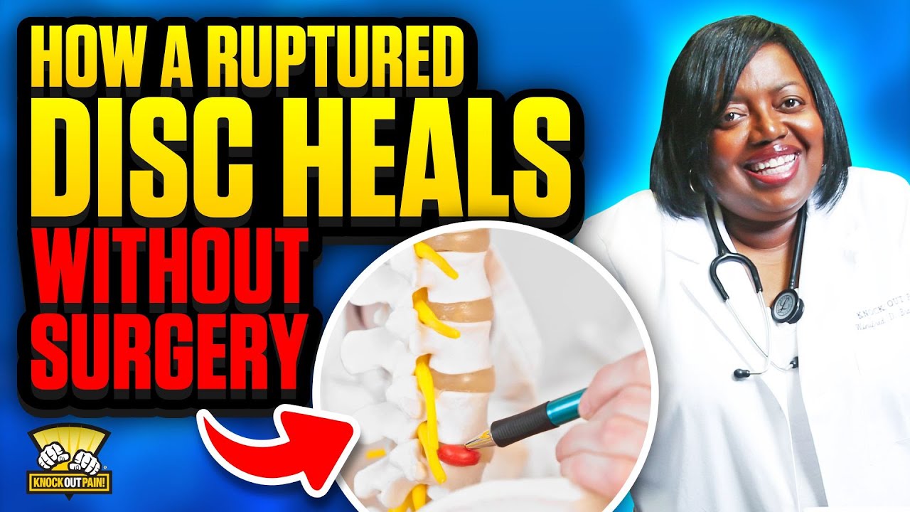 How a Herniated Disc Heals Naturally Without Surgery | Doctor Explains ...