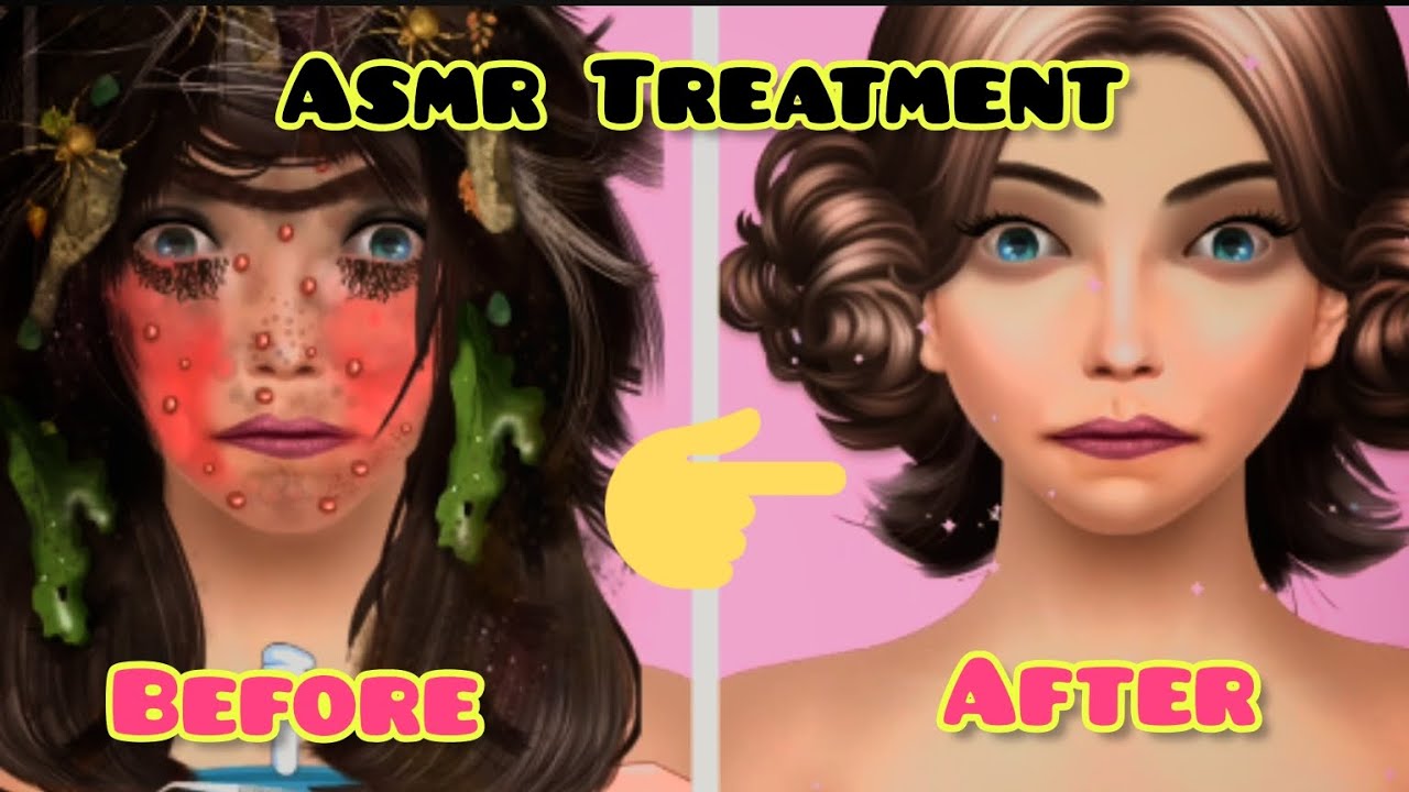 ASMR Face Pimple Care & Hairwash😷 |#pimpleproblem #asmr #trending - YouTube