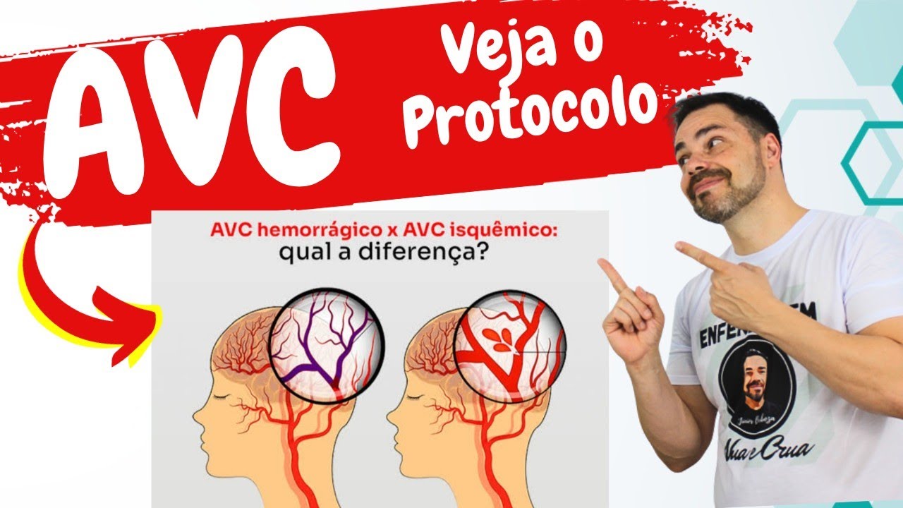 AVC Linhas de cuidados - Este vídeo vai te SURPREENDER - YouTube
