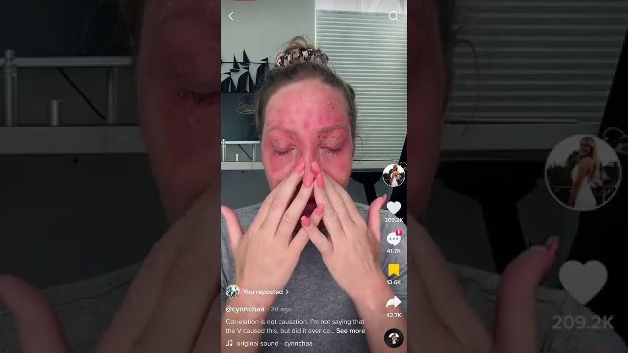 Check this out !!!💉🐍😳 - YouTube