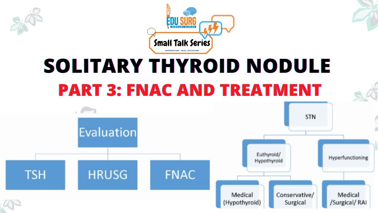 Management of solitary thyroid nodule - Part 3 - Edusurg Clinics - YouTube