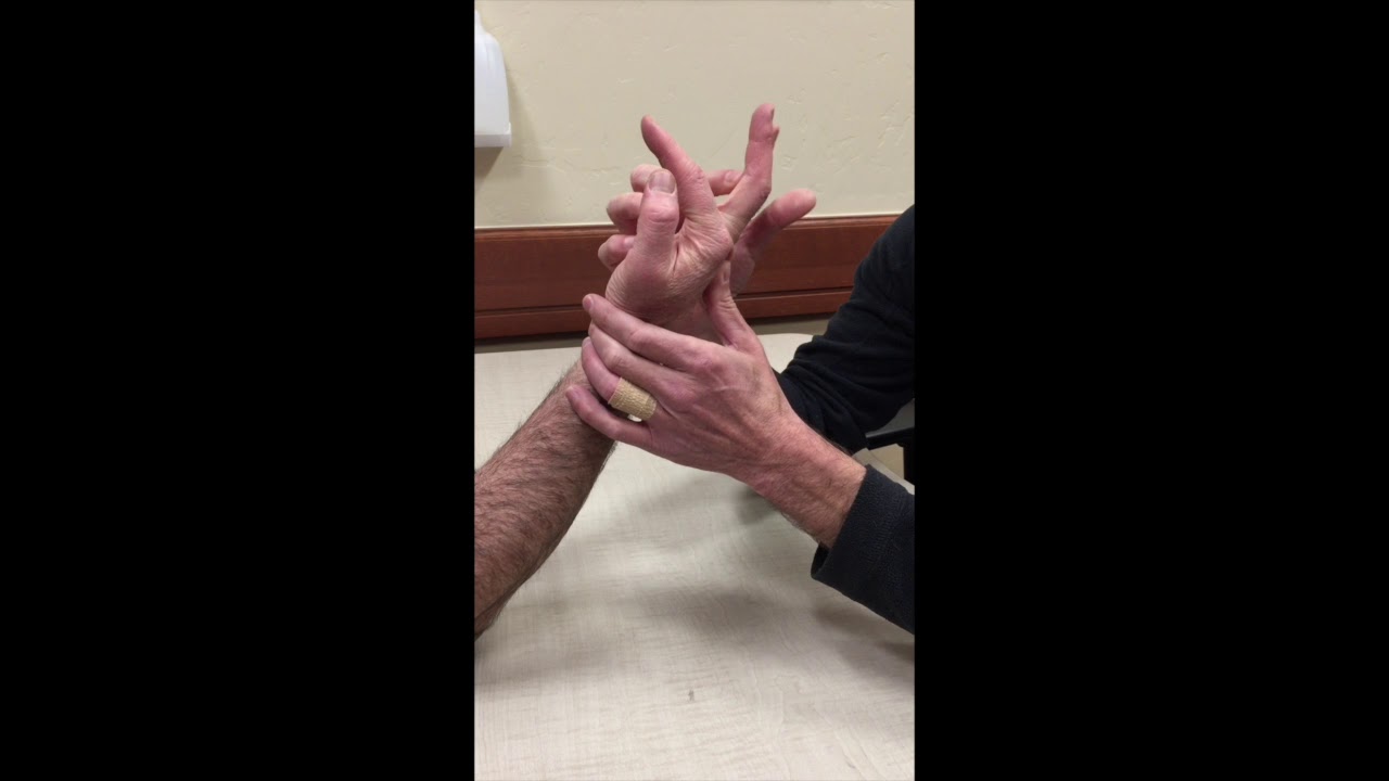 Intrinsic Hand Muscle Tightness Assesment - YouTube