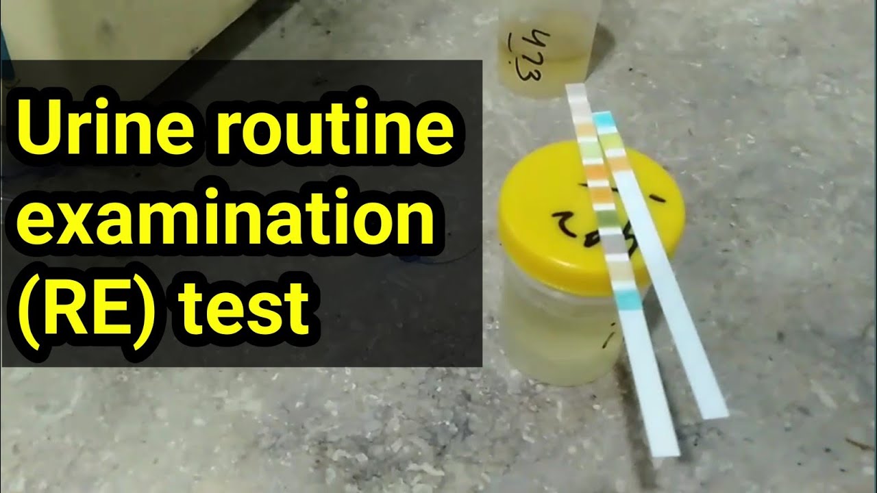 Urine routine examination (RE) test - YouTube