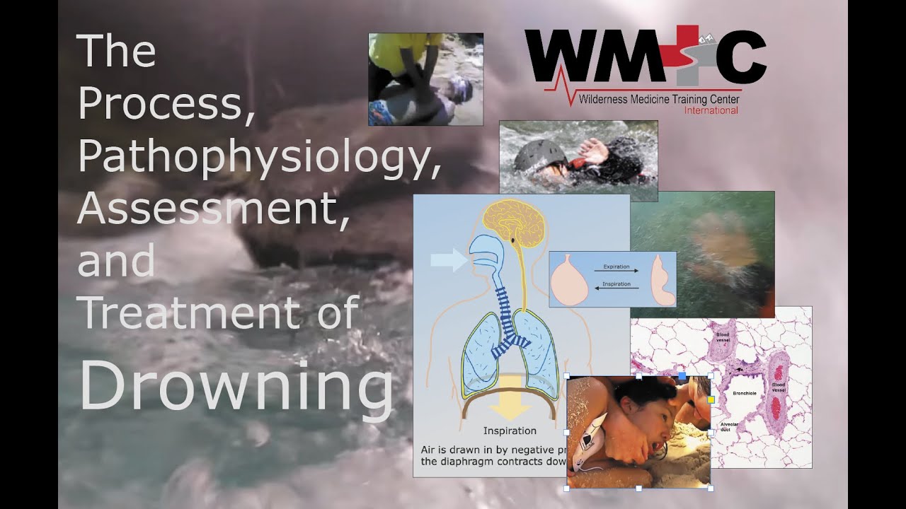 The Process, Pathophysiology, Assessment, and Treatment of Drowning ...