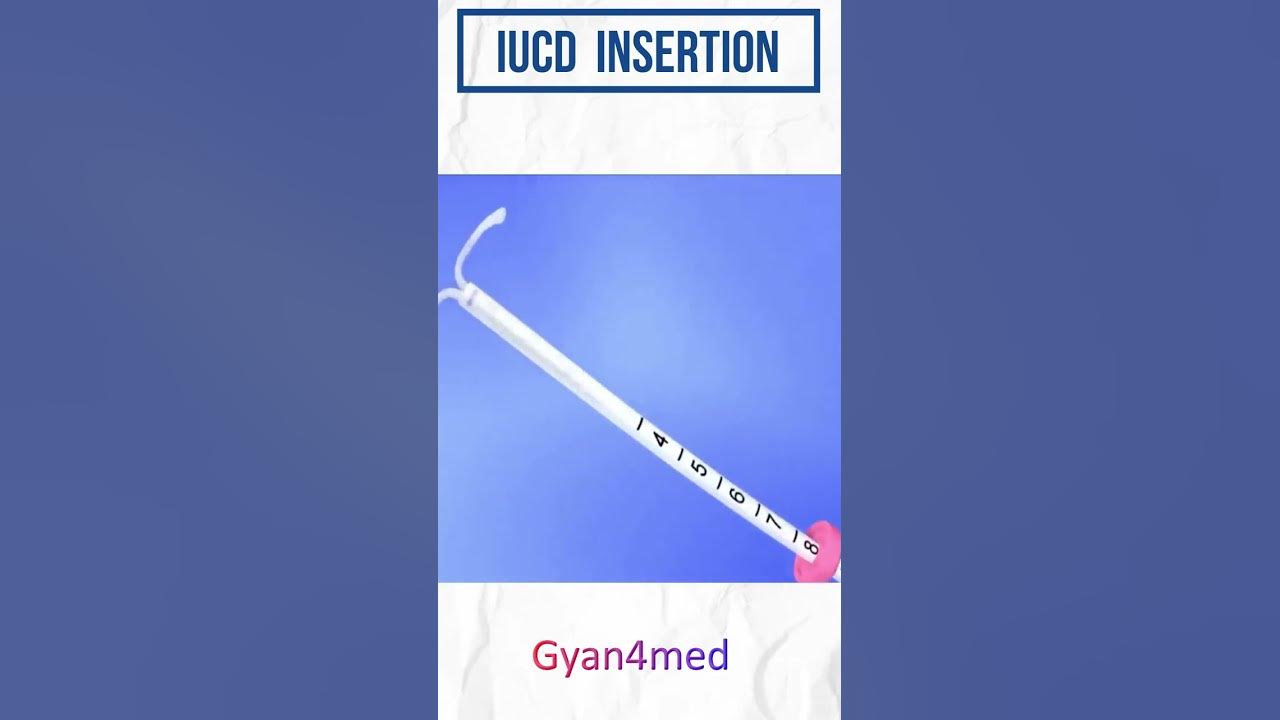 Iud Insertion Procedure In Hindi Youtube