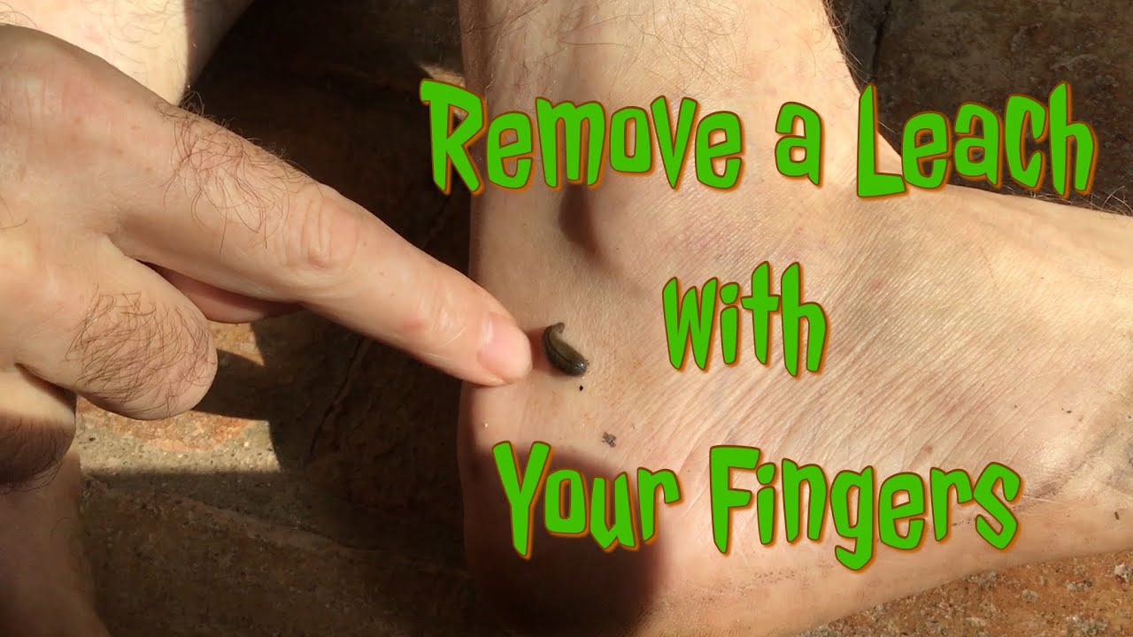 How To Remove A Leech - With Your Fingers - YouTube